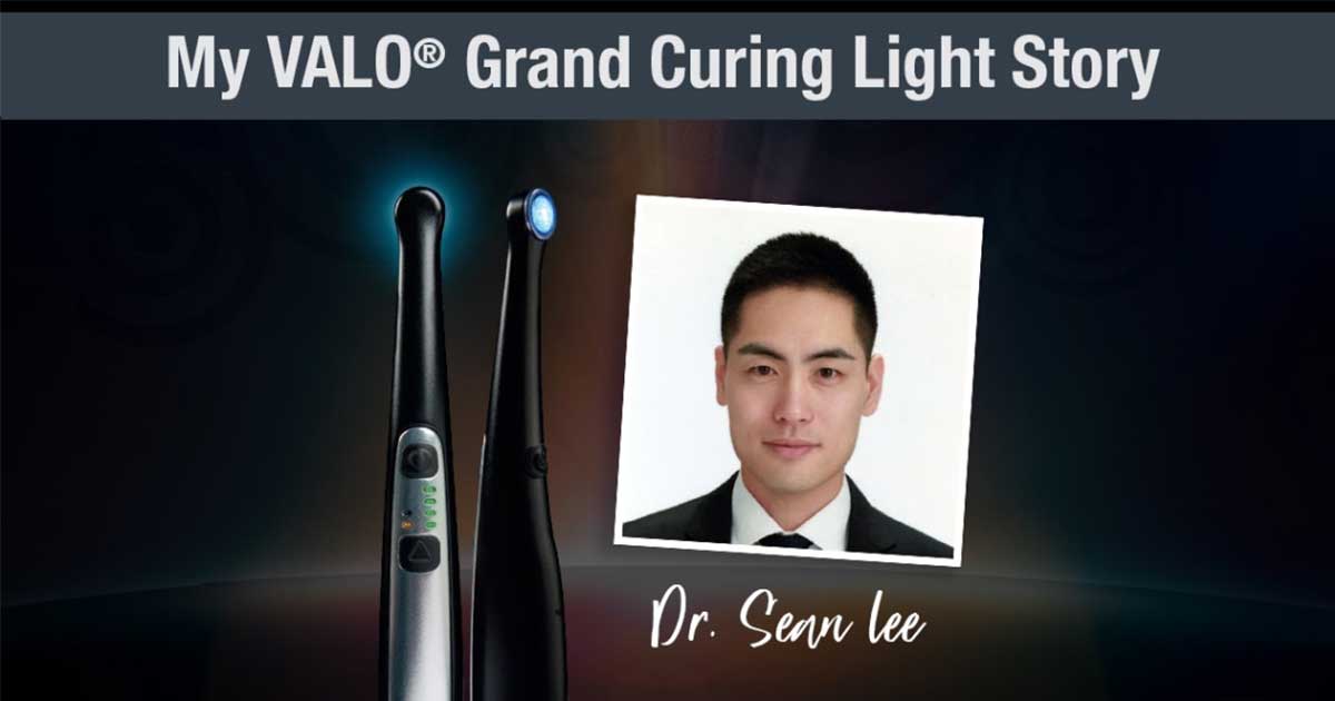 My VALO Grand Curing Light Story - NUDENT