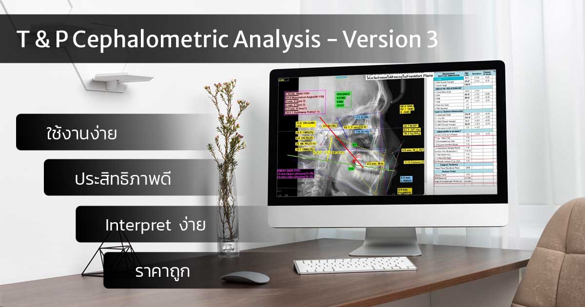 T & P Cephalometric Analysis (TP Ceph) - NUDENT